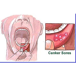 Miracle Write Smile - Essential Oxygen Rinse Mouthwash for Whiter Teeth, Fresher Breath, and Healthier Gums, Peppermint 12 fl. oz