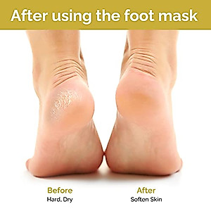 Foot Mask - 5 Pairs Lavender & Honey Foot Spa for Rough Dry Cracked Feet Reduce Dead Skin, Moisturizing Socks for Baby Foot, Relaxing Soft Feet Treatment for Women & Men, Foot Care Christmas Gifts