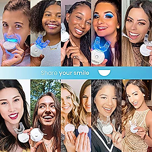Purean Teeth Whitening Kit with LED Light – 2 Syringes of 5ml Professional 35% Carbamide Peroxide Tooth Whitener Gel – Bright White Smile Set with Mouth Tray