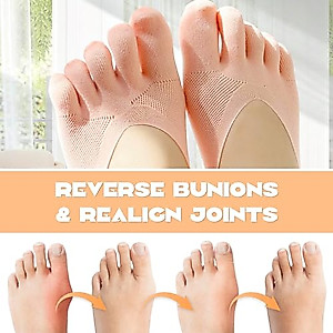 vvovvug Sock Align Toe Socks for Women, Projoint Anti Bunions Health Sock, Orthopedic Compression No Show Five Finger Socks(6pairs)