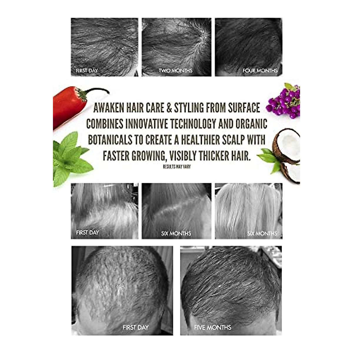 Surface Hair Awaken Therapeutic Conditioner, Healthy Hair Conditioner with Protein, Thickening Conditioner, Treatment for Thinning Hair and Hair Loss