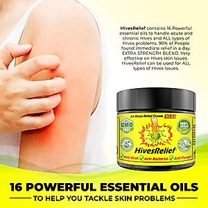 HivesRelief Cream - Fastest Acting Powerful Hives Relief Cream with 100% Natural Formula - Gentle Skin Irritation Cream for Hives Itchiness, Redness & Rashes - for Adults & Kids