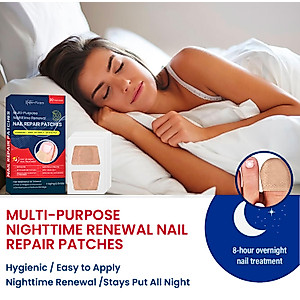 Multi-Purpose Fungus Nail Patches, Toenail Fungus Treatment, Nail Fungus Treatment for Toenail, Ingrown Toenail Treatment, Toe Nail Fungus Treatment Extra Strength, Nighttime Fungal Nail Patches