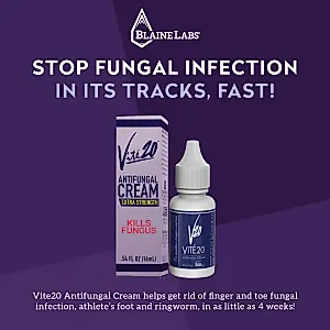 V20 Vite 20 Antifungal Cream Fungus Killer Hand and Feet Nail Treatment