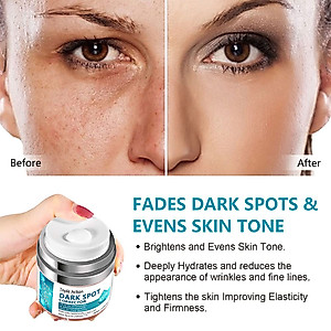 Dark Spot Remover for Face, Fast-Acting Dark Spot Corrector Remover for Face and body Hyperpigmentation, Fades Melasma, Freckle, Sun Spots, Evens Skin Tone, Age Spot Remover for Women Men