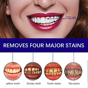 Teeth Whitening Pen 4 Pens for 70+ Uses, Twice a Day for Visibly Whiter in 1 Week, Effective Painless No Sensitivity Vanilla Mint Flavor