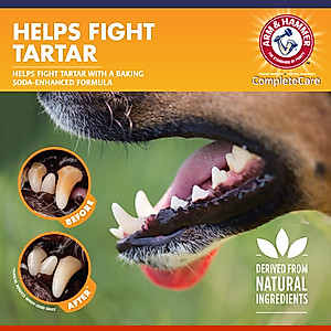 Arm & Hammer Dog Dental Kit - Enzymatic Dog Toothpaste 2.5 oz Chicken Flavor - Dog Toothbrush & Finger Brush - Tartar & Gum Cleaning with Baking Soda Enhanced Formula - Complete Dental Care for Dogs