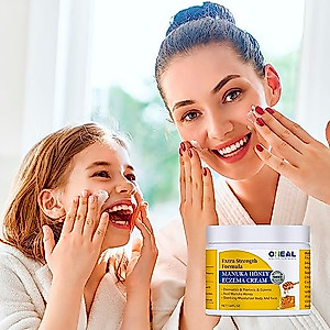 OHEAL Manuka Honey Eczema Cream, Eczema Psoriasis Shingles Honey Cream for Dry Skin, One Bottle for Dermatitis Cream, Psoriasis Treatment for Skin, Eczema Honey for Ringworm Treatment, 3.4 oz