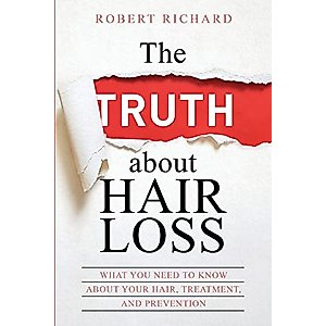 The TRUTH about Hair Loss: What You Need to Know about Your Hair, Treatment, and Prevention (Hair Loss Cure, Alopecia, Mpb, Male Pattern Boldness, Hair Loss Treatment)