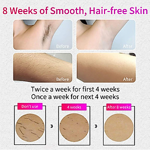 VEME IPL Laser Hair Removal for Women & Men Permanent Painless, at-Home Hair Removal Device - Facial, Lip, Bikini, Whole Body,FDA Cleared,Auto Mode/ 5 Energy Upgraded Professional Hair Remover