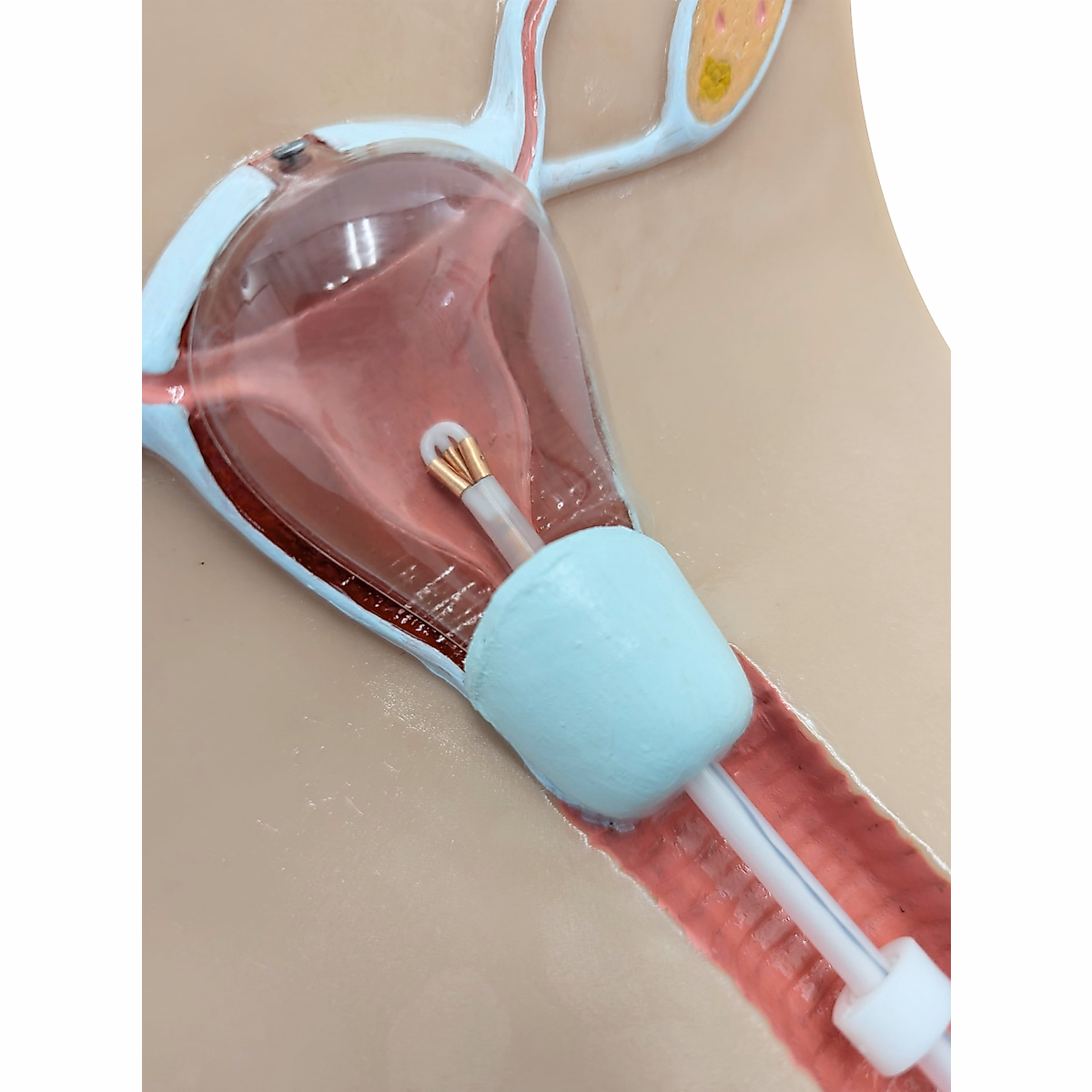 Anatomy Lab IUD Insertion Model I