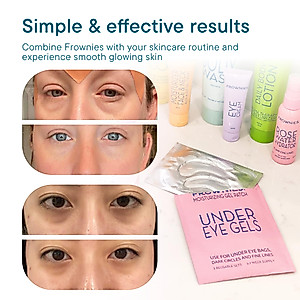 Frownies Under Eye Gel Patches for Puffy Eyes - Dark Circles with Cactus Collagen - Reusable, 3 Pack