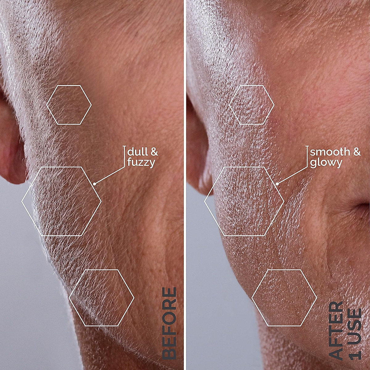 Michael Todd Beauty - Sonicsmooth – SONIC Technology Dermaplaning Tool - 2 in 1 Women’s Facial Exfoliation & Peach Fuzz Hair Removal System with 8 Weeks of Dermaplaning Blades