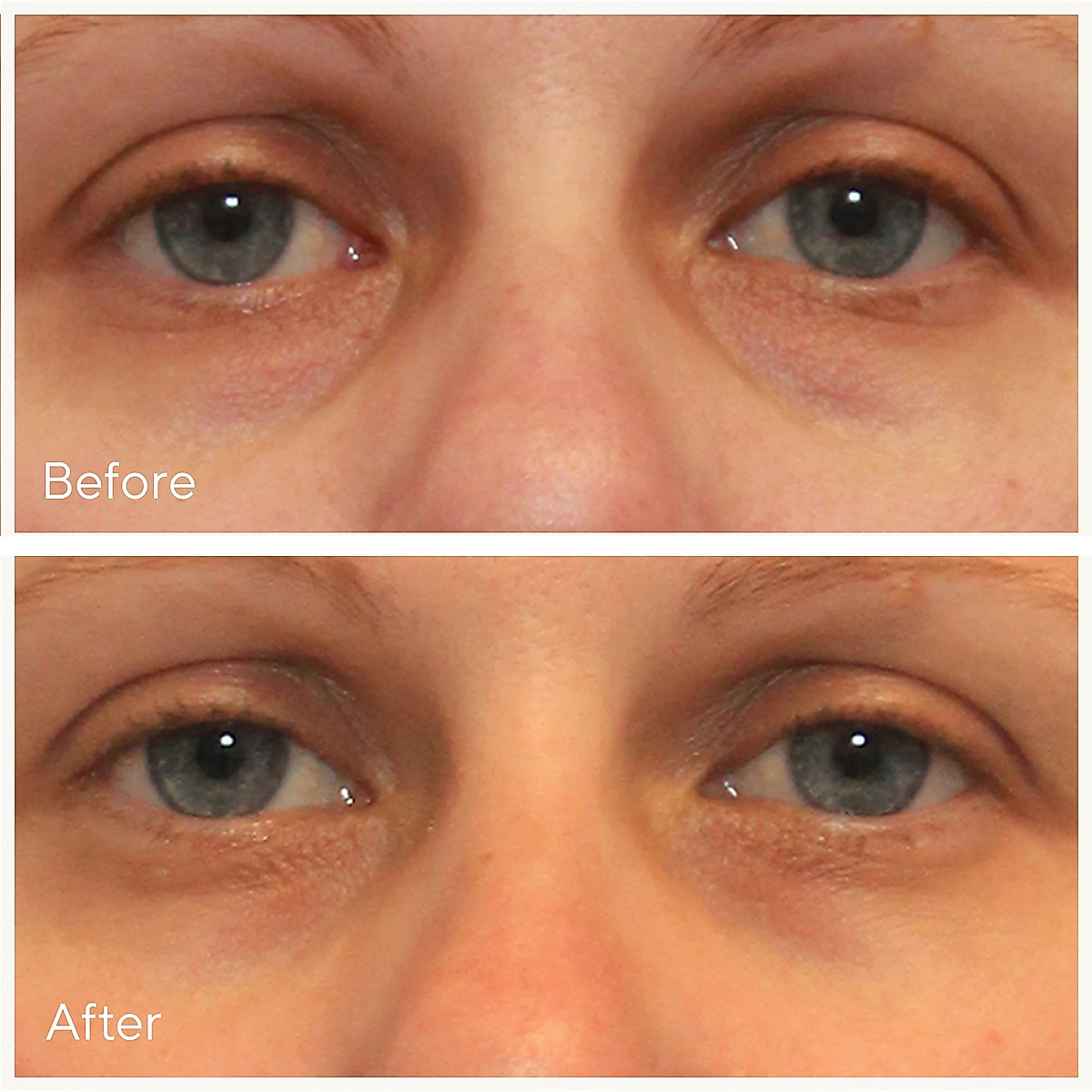 Murad Vita-C Eyes Dark Circle Corrector – Environmental Shield Vitamin C Brightening Serum – Anti-Aging Treatment for Puffiness and Wrinkles, 0.5 Fl Oz