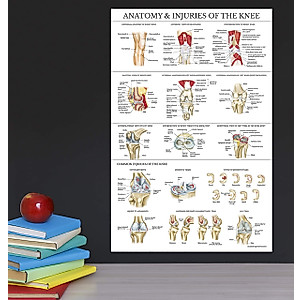 Palace Learning Laminated Anatomy and Injuries of the Knee Poster - Knee Joint Anatomical Chart - 18" x 24"