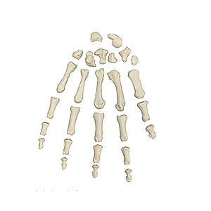 Wellden Medical Full Disarticulated Skeleton, Human Anatomical, Life-Size, 170cm