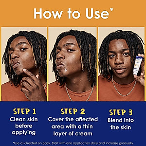 Clearasil Stubborn Acne Control 5in1 Spot Treatment Cream, Maximum Strength, Benzoyl Peroxide Acne Medication, Fights Blocked Pores, Pimple Size, Excess Oil, Acne Marks & Blackheads, 1 oz (Pack of 4)