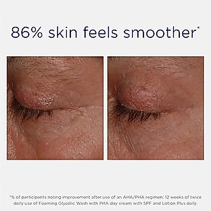 NEOSTRATA Lotion Plus Advanced AHA Exfoliating Lotion with Glycolic Acid For Face & Body, 6.8 fl. oz.