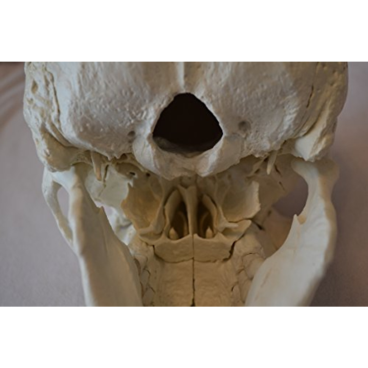 Wellden Medical Anatomical Adult Osteopathic Skull Model, 22-Part, Life Size, Bone Color