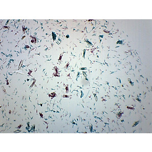 EISCO 10PK Mixed Diatoms, Wholemount - Prepared Microscope Slides - Classroom Pack, 10 Slides in Storage Case - Biology & Microscopy