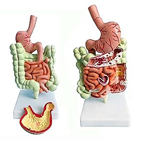 HEYBEC Model of Human Gastrointestinal Anatomy,Model of The Human System, Colon Disease Model, Structure of The Internal Organs for Teaching in Medical Displays