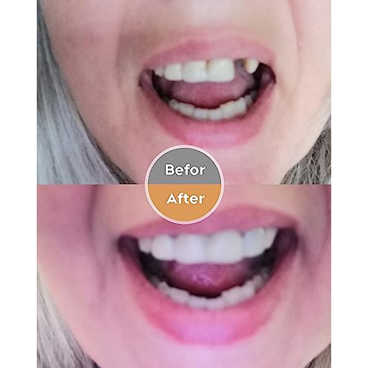 Dentures DIY Kit, Create Your Perfect Smile at Home: DIY Denture Fake Teeth Kit - Easy, Affordable, and Customizable Denture Solution