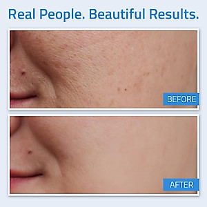 YEOUTH Regenotin Collagen Support for Skin, Nails, Hair, and Joints, Vegetarian Dietary Supplements for Men and Women, 60 Capsules