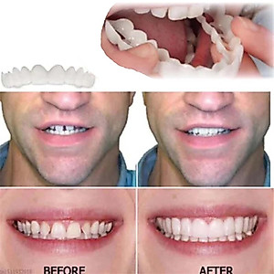 2 Pairs of occlusal Tooth veneers and Smiling Tooth veneers to Protect and Cover Imperfect Teeth, and whitening Braces to Keep Teeth White and Tidy,… (Large Size)