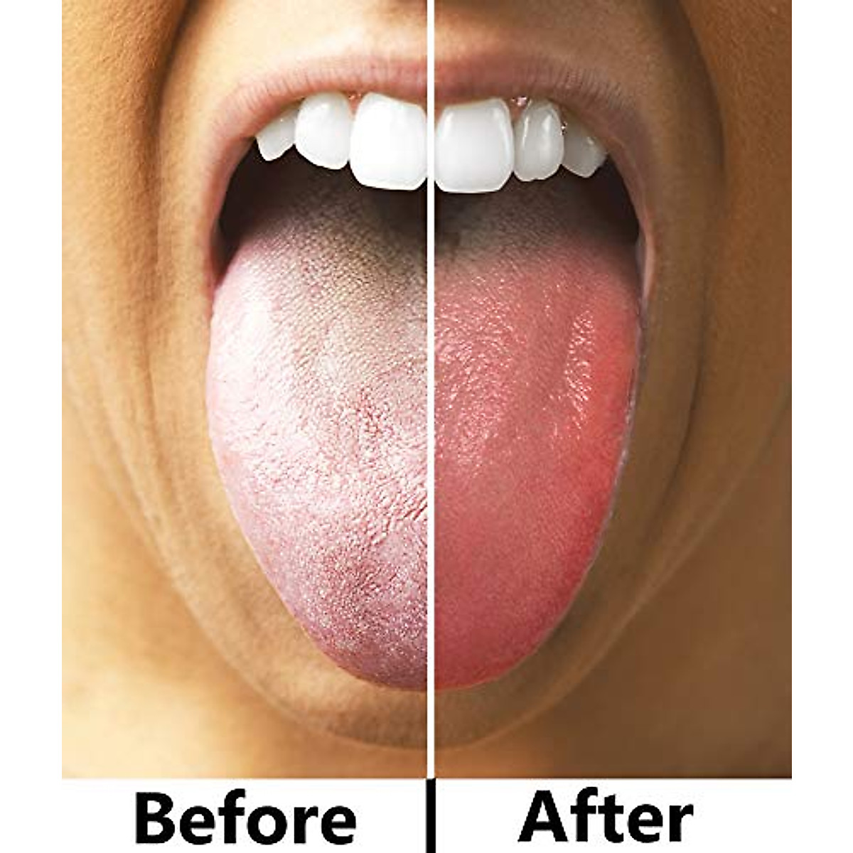 Tongue Scraper Cleaner (2 Pack) Medical Surgical Grade Stainless Steel Metal Tongue Brush Dental Kit Eliminate Bad Breath with Tongue Sweeper Ayurvedic for Daily Oral Dental Hygiene Fresh Breath