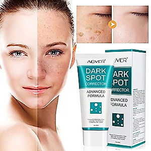 Dark Spot Remover for Face, Dark Spot Corrector Cream, Fade Out The Skin Black Precipitate, Remove Freckle for Face, Fade Spots for All Skin Tone Types