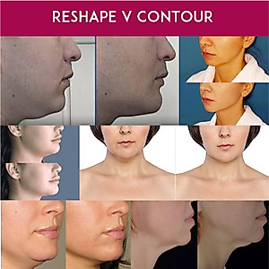 Anacis Advanced Neck Cream - Neck Chin & Jawline Anti Aging Cream for Women and Men 30 ml