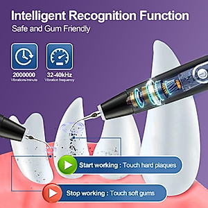 VVHOMIFE Dog Teeth Cleaning Kit-Dog Tooth Plaque Remover-Ultimate Pet Dental Care Kit - Ultrasonic Teeth Cleaner and Plaque Remover for Dogs | Complete Oral Hygiene Solution-Black