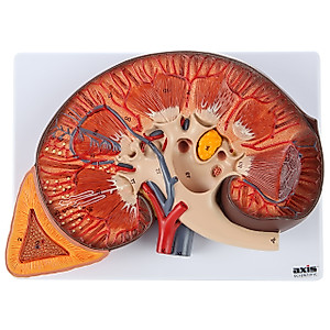 Axis Scientific Human Kidney Model | Anatomical Model is Enlarged to 3 Times Life Size | Includes Anatomy of Adrenal Gland and Nephrons | Includes Product Manual