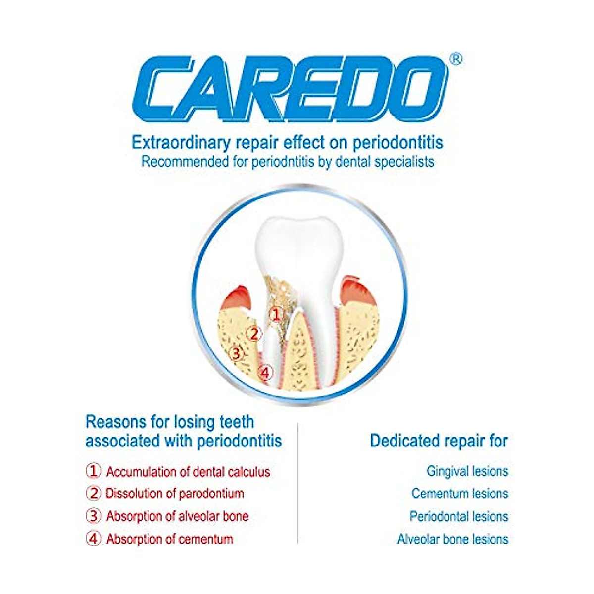 CAREDO Healing Periodontitis Treatment At Home Toothpaste, Periodontal Disease Treatment 3.52oz 2 Tubes, Gingivitis Treatment for Gum Disease, Fluoride Free Toothpaste for Bleeding Gums and LooseTeeth