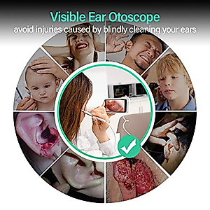 Ear Wax Removal Otoscope,Sinohrd Ear Camera with 5 Inch 1080P HD Screen Ear Scope Otoscopes,3.9mm Light Lens Inspection Endoscope Ear Wax Removal Tool USB Rechargeable Otoscope