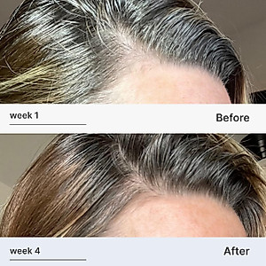 Better Not Younger Superpower Hair & Scalp Duo Set - Fortifying 2fl.oz. plus Liquid Comb - Leave-in Serum w/ Massaging Applicator for Stronger, Thicker, Fuller