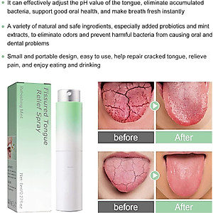 Canada Polumna Fissured Tongue Relief Spray, Regulates Oral Health, Fresh Breath Spray for All People Fissured Tongue Treatment, Breath Freshener Spray for Women Men (4)