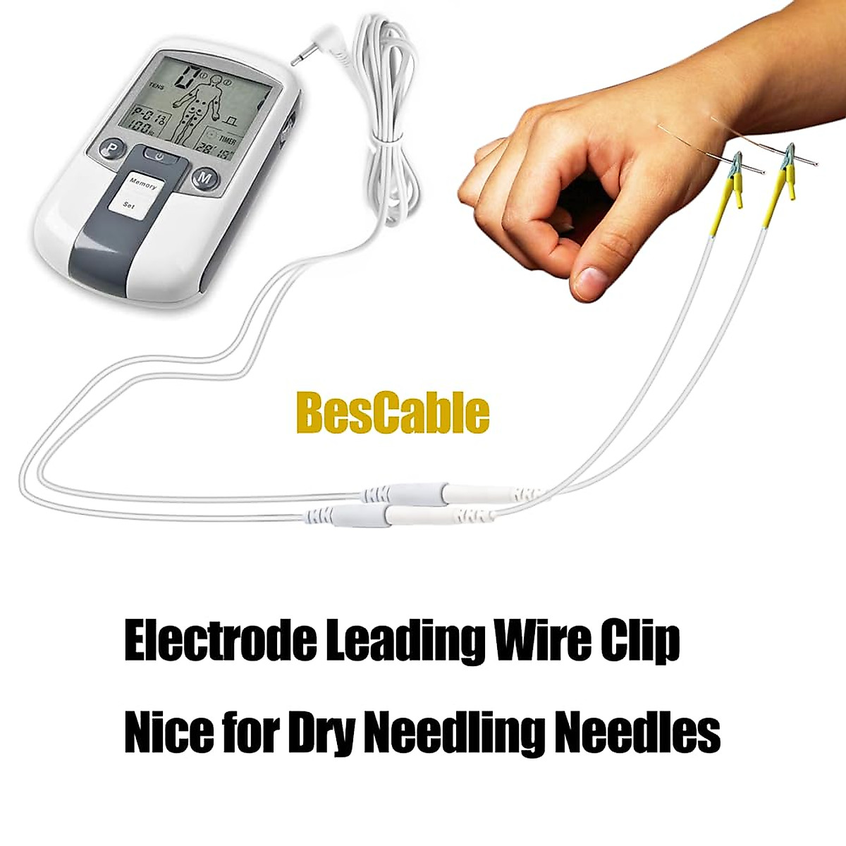 Electrode Wire for Dry Needling Needles - BesCable 20pcs TENS Leading Wires with Alligator Clips for TENS Unit Physiotherapy Machine - 2.0mm Pin Female to Alligator Clip Cable