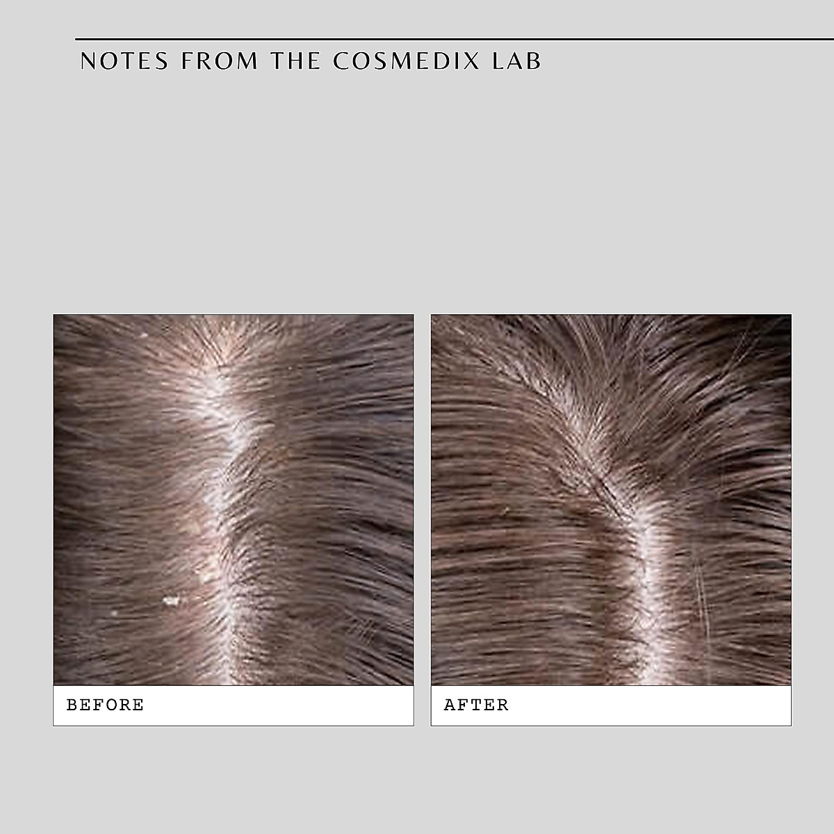 COSMEDIX Fortify Cooling Enzyme Scalp Treatment, 1 ct.