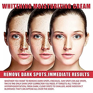 Whitening Cream, NewBet Skin Lightening Cream for Face & Body, Dark Spot Corrector Moisturizing Cream for Sun Spots, Age Spots, Hyperpigmentation, Instant Result (1 Pcs)