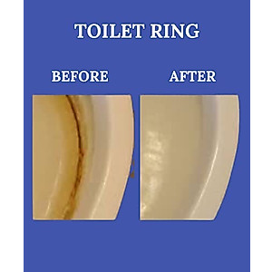 Ring King Toilet Ring Remover, Toilet Bowl Ring Cleaner, Multi-Surface Calcium stain, Water Stain, Rust stain, Red clay stain, Lime stain remover, Fast Acting No Scrubbing