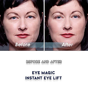 Eye Magic Premium Eye Lift (S/M Refill) Made in America. Instantly Lifts and Defines Droopy, Sagging or Hooded Eyes Safe for Daily Use