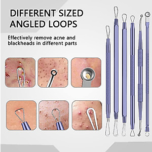 Xesscare Latest Pimple Popper Tool Kit, 16 Pcs Blackhead Remover Tool, Comedone Extractor Acne Removal Kit, Professional Whitehead Tweezers with Metal Case for Facial, Nose and Forehead (Purple)