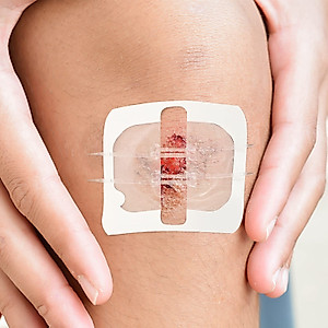 Healeved 2pcs Closure Emergency Closures Band Patch Emergency Device Tool Tool Stickers White PVC