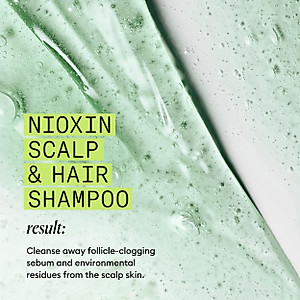Nioxin System 2 Shampoo & Conditioner Prepack, Natural Treated Hair with Progressed Thinning, Pumps Included, 33.8 fl oz (Packaging May Vary)
