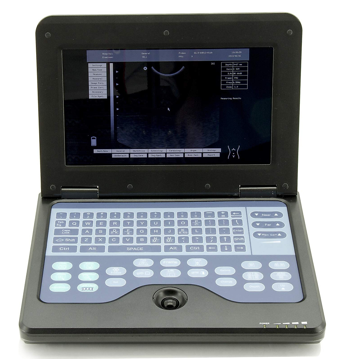 Portable Vet/Veterinary B-Ultrasound Scanner with 3.5Mhz Convex Probe for Horse,Goat,Cow,Sheep and Pig use