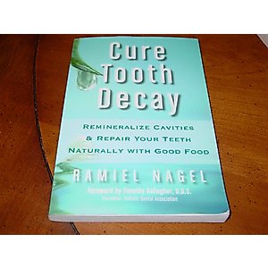 Cure Tooth Decay: Heal and Prevent Cavities with Nutrition, 2nd Edition
