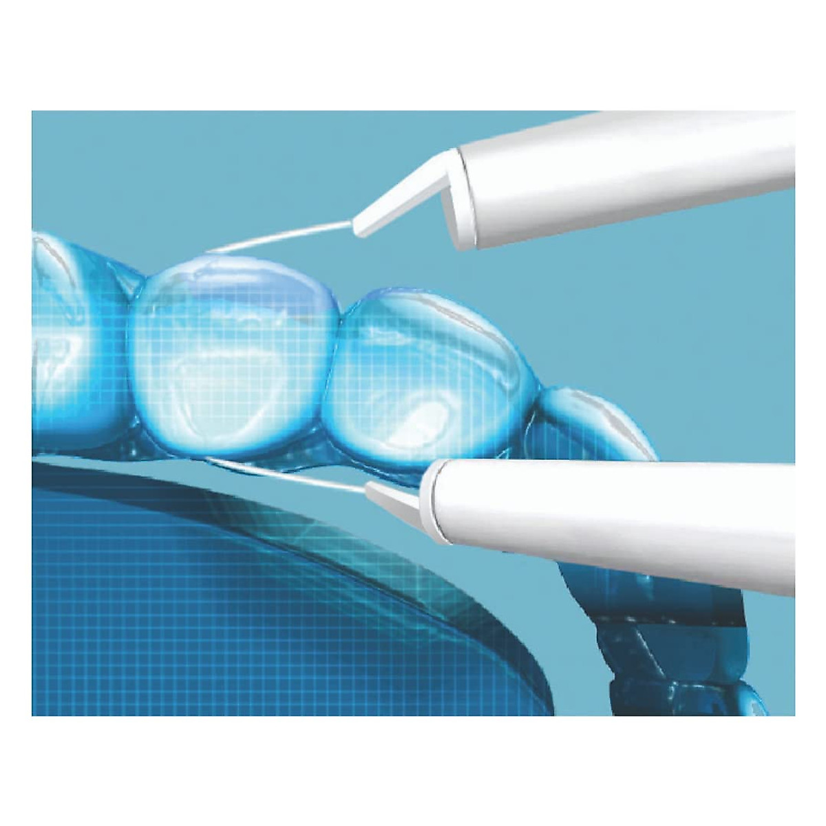 GumChucks Orthodontic Flossers Dental Floss - Floss for Braces - Brace Floss Picks - Gum Flossing Picks - Ortho Dental Flossers (Adult Starter Pack)