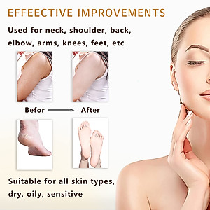 Seed Spring 24K Gold & Sugar Body Scrub - Exfoliating Body Scrub - Moisturizing & Deep Cleansing - Remove Dead Skins - Anti Aging Hydrating Body Scrub for Women Men - 10 oz