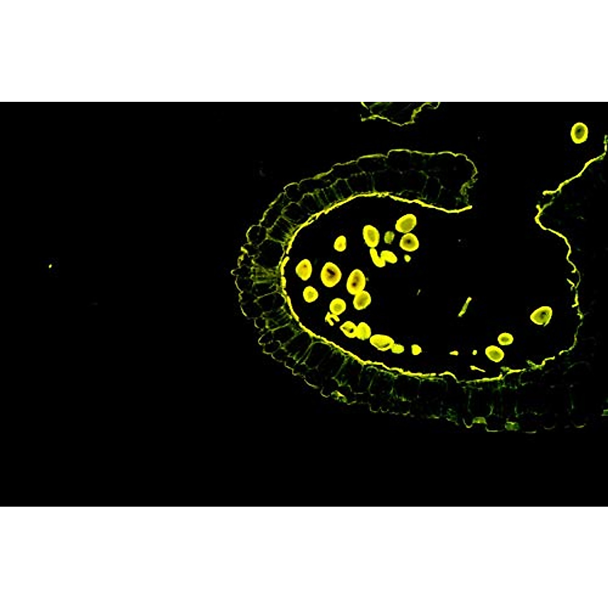 Labomed HD VGA Digital Camera (3.2MP)